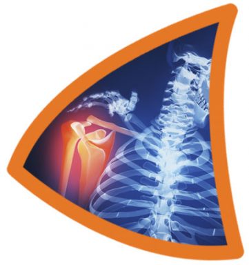 Frozen Shoulder (Adhesive Capsulitis) – Rotherham Physio Centre